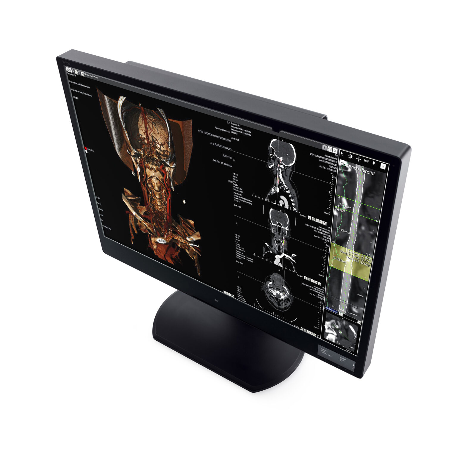 High-Tech LCD Monitors - Anxo Components - Electronic Sales Rep